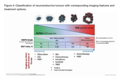 Neuroendocrine (NETs) Cancer Grading | Neuroendocrine Tumour Grading