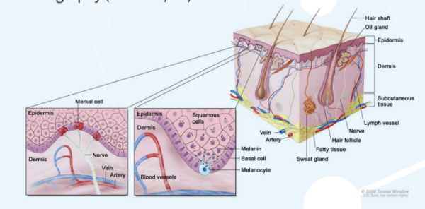 Merkel Cell Carcinoma